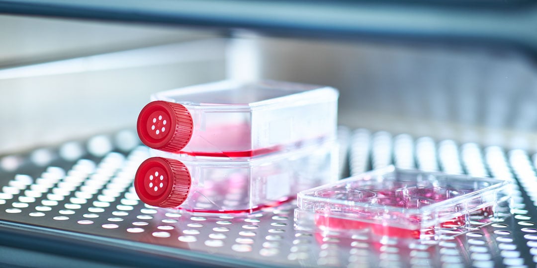 Request HLA-typed human primary cells | PromoCell Request HLA-typed human primary cells | PromoCell